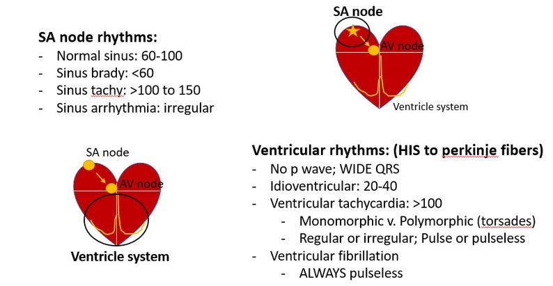 Cardiac Conduction Review - Etsy