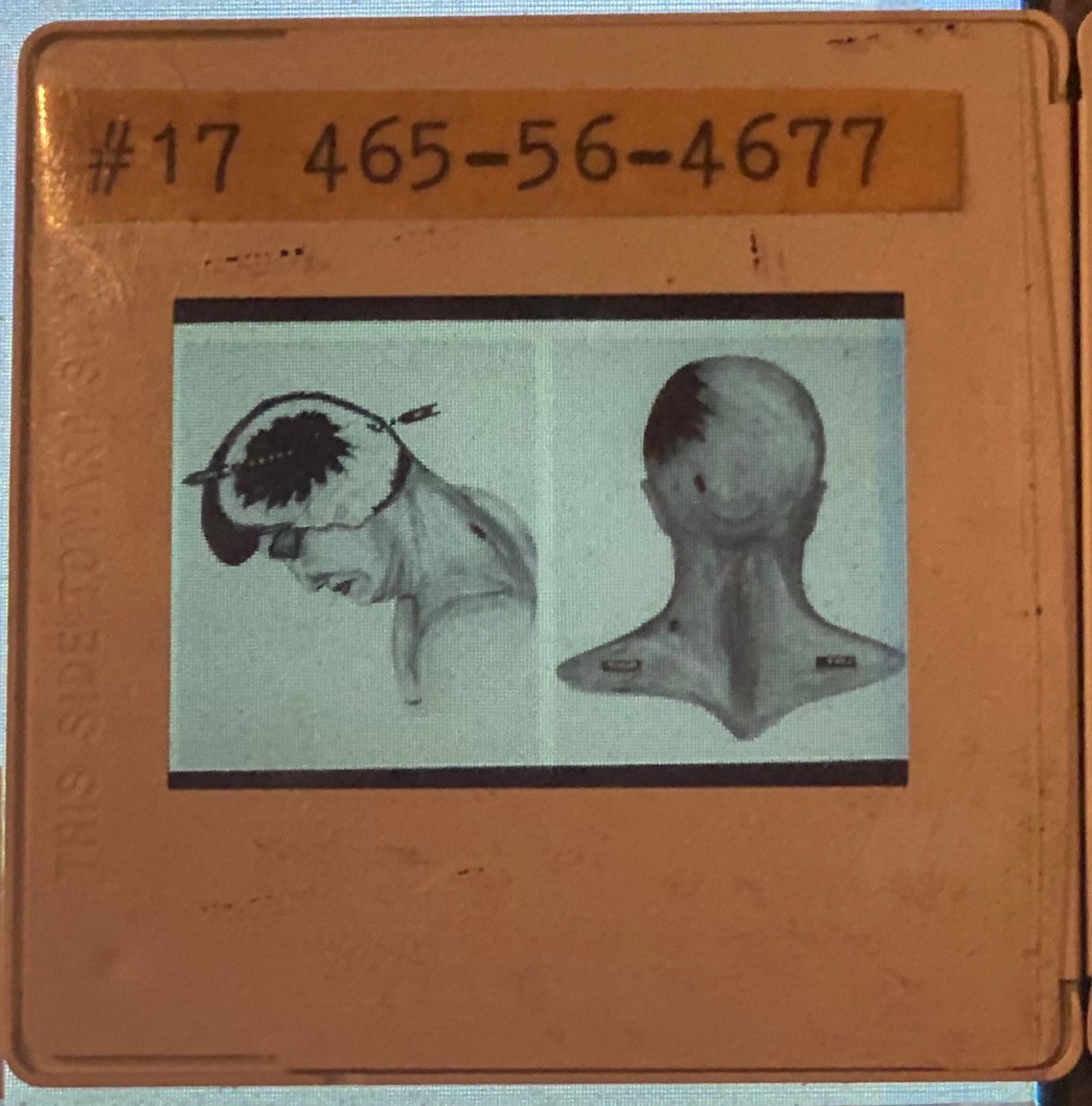 Slides of Drawings of JFK Autopsy Photos Used in Warren Commission ...