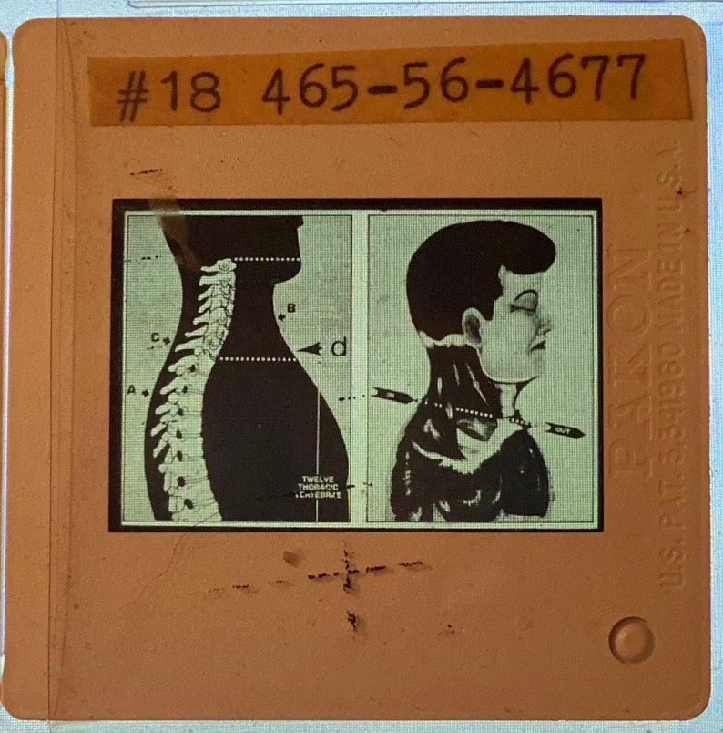 Slides of Drawings of JFK Autopsy Photos Used in Warren Commission ...