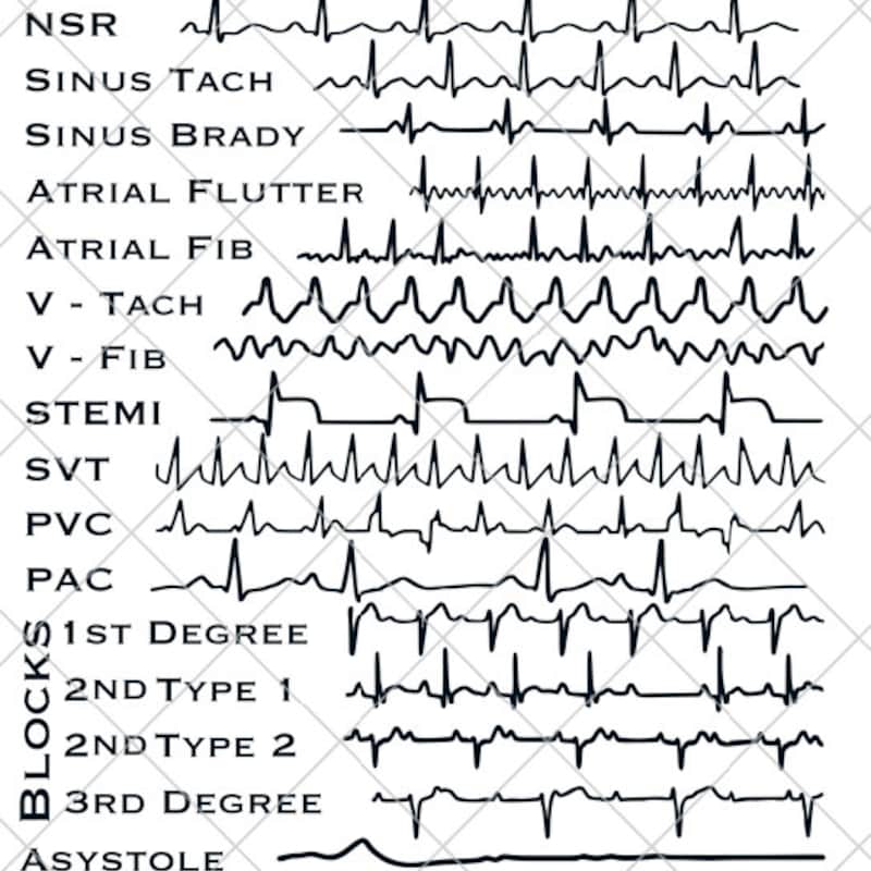 Cardiac Monitor Tech Gift - 60+ Gift Ideas for 2026