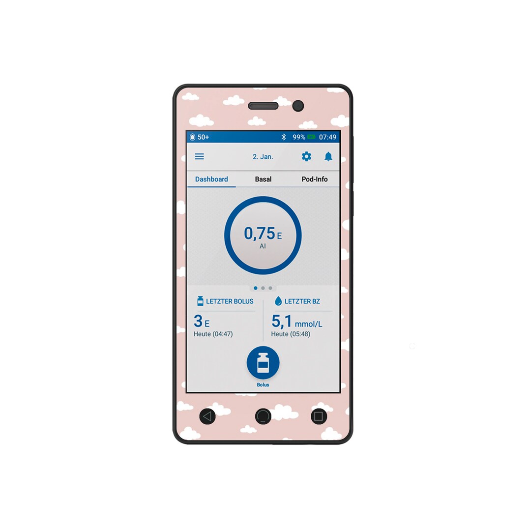 Omnipod Dash PDM Sticker "pinky Clouds" | decorate Your Devices | Type ...