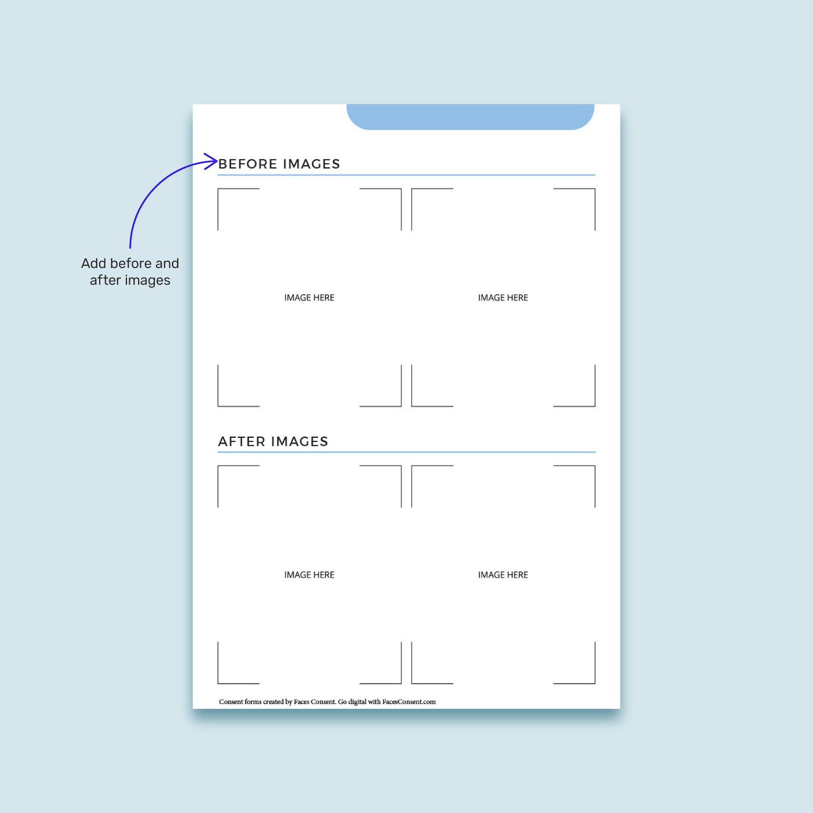 Phlebotomy Consent Form - by Faces Consent - Etsy