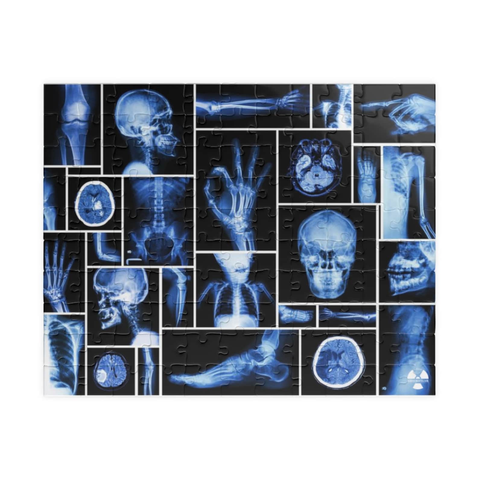 Radiology Jigsaw Puzzle 110, 252, 500-piece, Rad Tech Gifts, Mri, X-ray ...