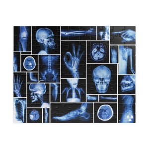 Radiology Jigsaw Puzzle (110, 252, 500-piece), Rad Tech Gifts, Mri, X ...