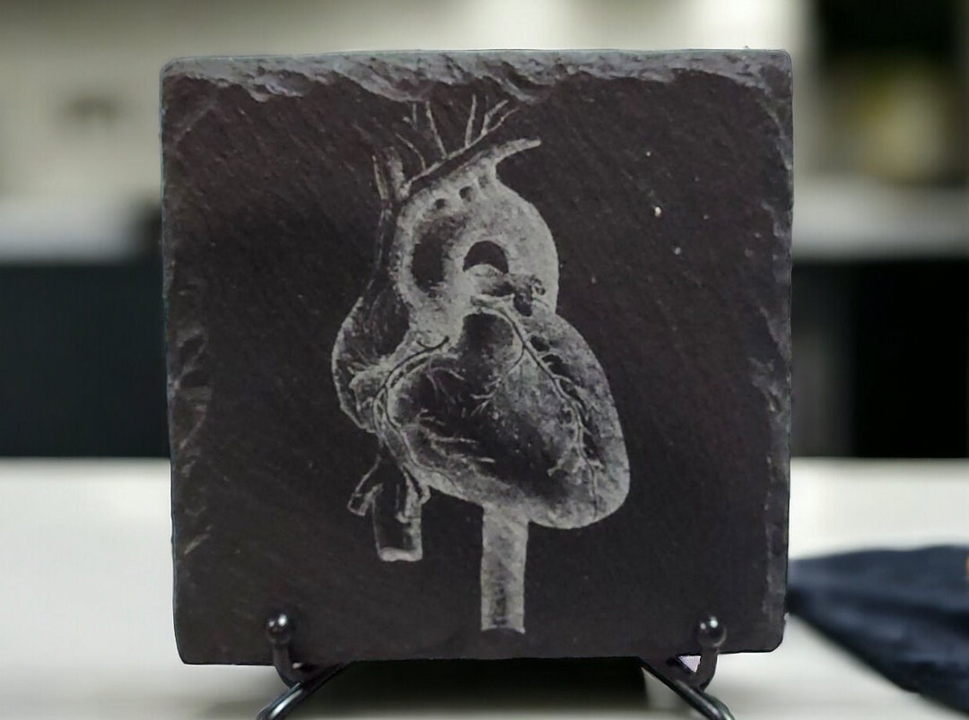 Cardiology Coasters: Celebrate the Wonders of the Human Heart With Our ...