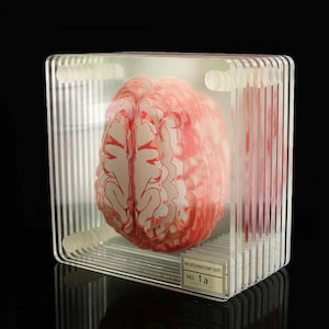 MD-11149 Brain Specimen Coasters Set 3D Organ Brain Artwork Brain ...