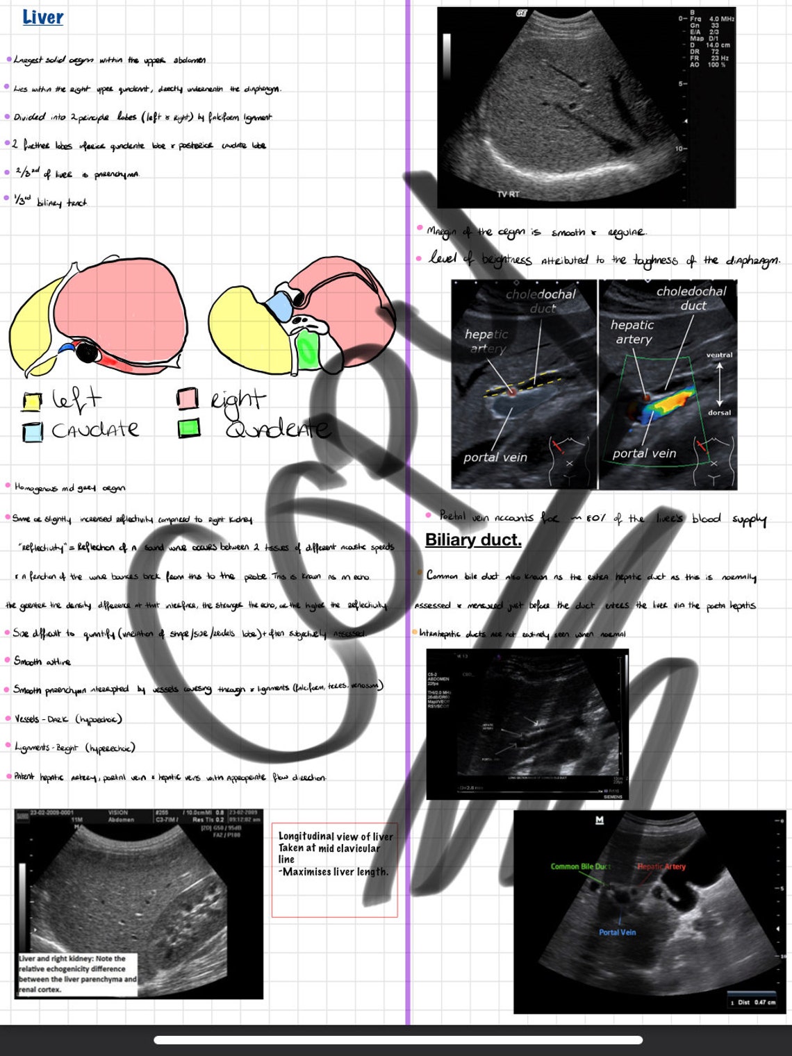 Abdomen Revision Sheets Includes Liver, Pancreas Etc. Centred Around ...