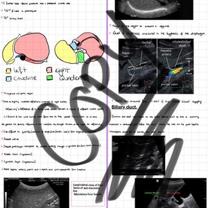 Abdomen Revision Sheets Includes Liver, Pancreas Etc. Centred Around ...