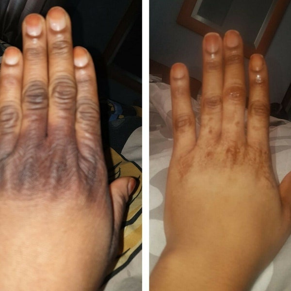 Dark Knuckle Serum - Etsy