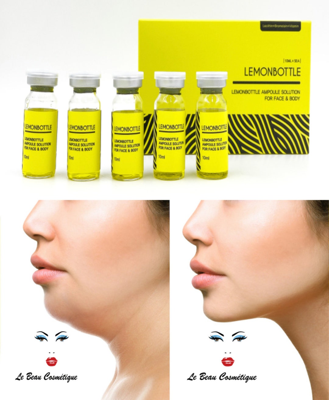 Lemon Bottle Skin Fat Dissolvent Ampoule SOLUTION 5 X 10ML - Etsy