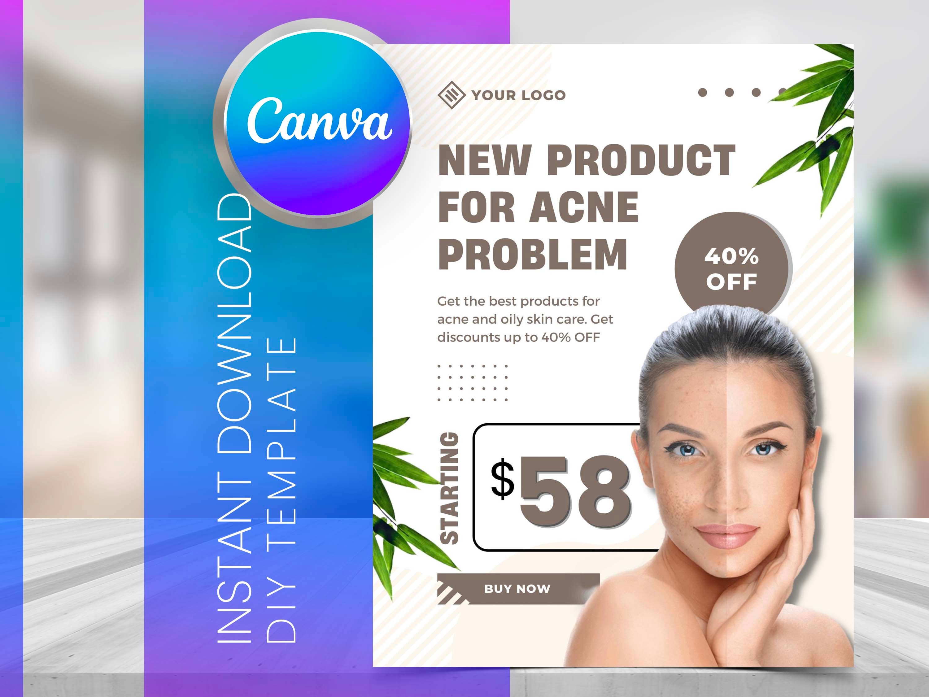 ACNE TREATMENT FLYER Diy Editable Canva Template, Printable & Social ...