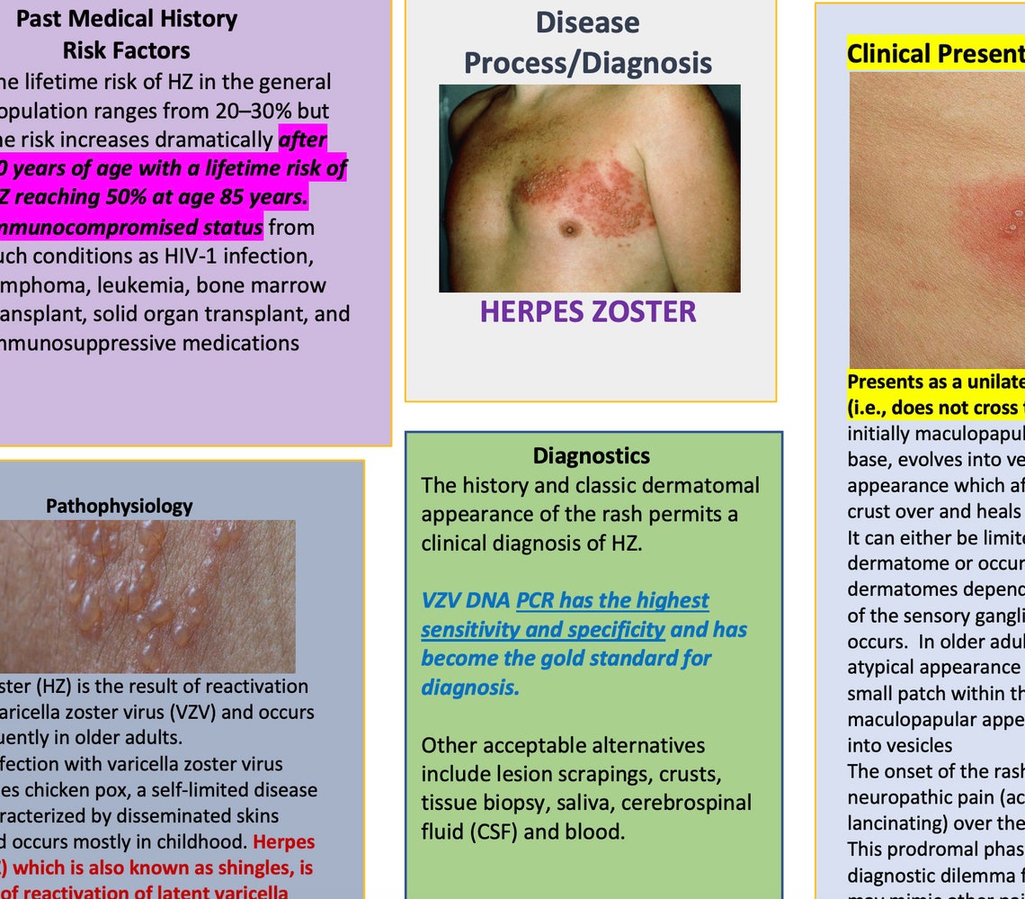 Herpes Zoster Concept Map and Study Guide - Etsy