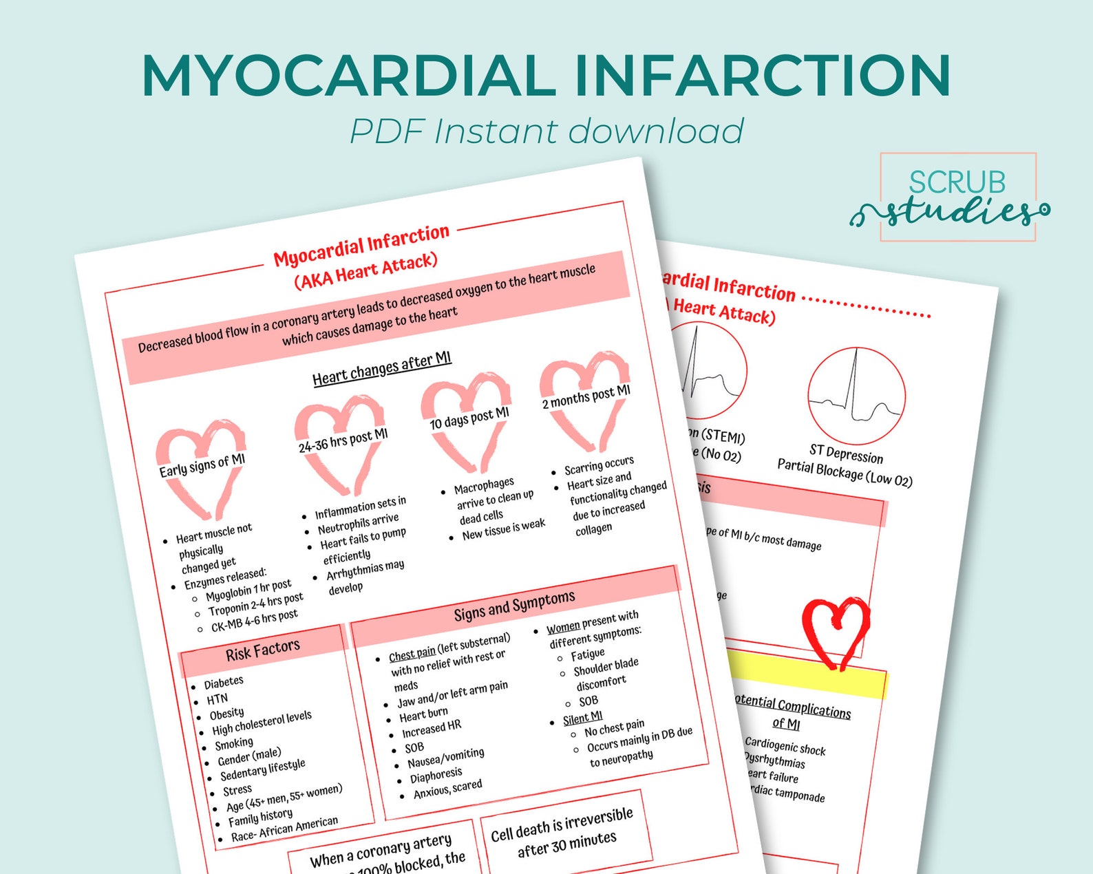 Cardiac Bundle Study Guide Nursing Study Guide Heart - Etsy