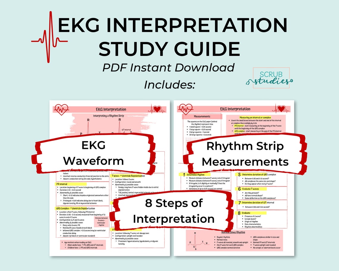EKG Interpretation Study Guide | EKG Arrhythmias | ECG | Nursing ...
