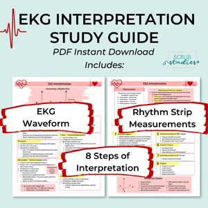 EKG Interpretation Study Guide | EKG Arrhythmias | ECG | Nursing ...