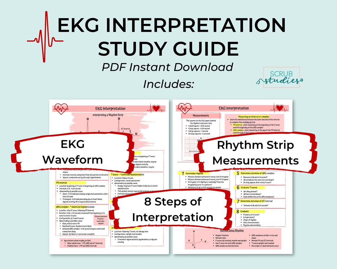 EKG Interpretation Study Guide EKG Arrhythmias ECG - Etsy
