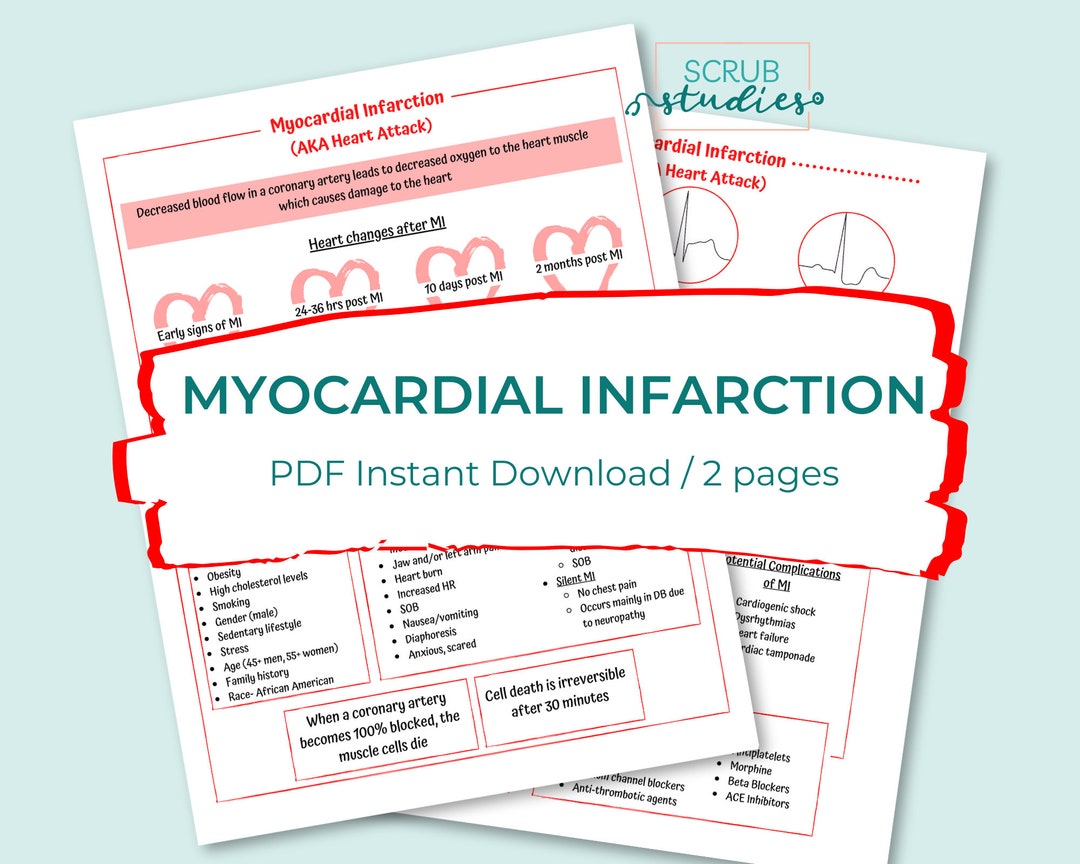 Myocardial Infarction Study Guide | Nursing Study Guides | Digital ...