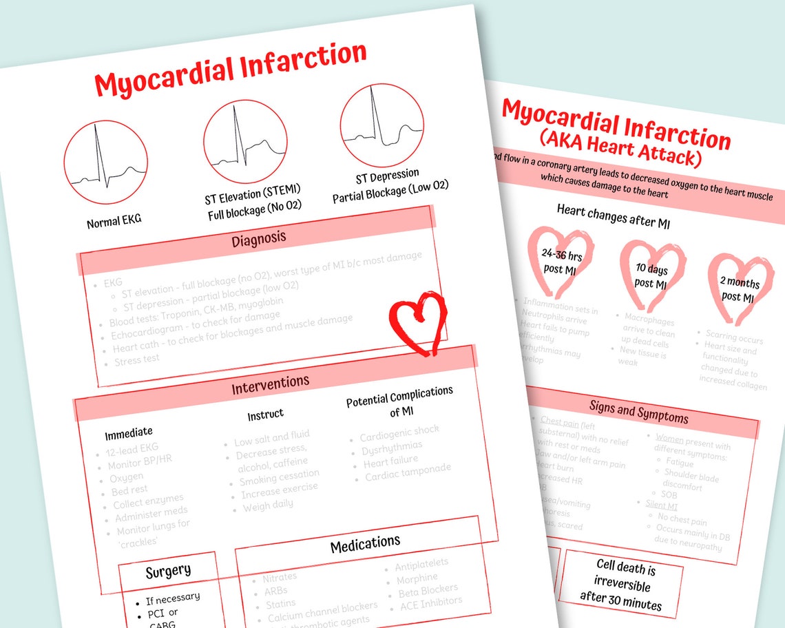 Myocardial Infarction study guide Nursing study guides | Etsy