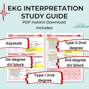EKG Interpretation Study Guide EKG Arrhythmias ECG - Etsy
