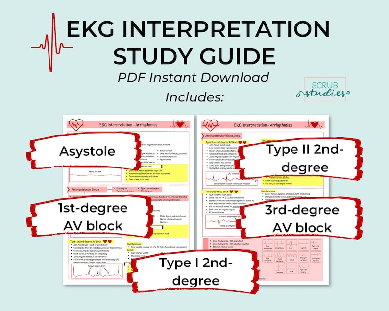 EKG Interpretation Study Guide EKG Arrhythmias ECG - Etsy
