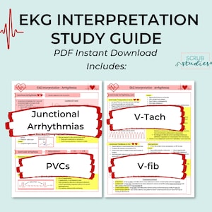 EKG Interpretation Study Guide | EKG Arrhythmias | ECG | Nursing ...
