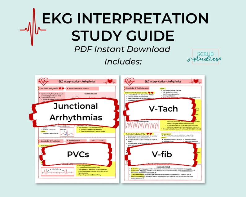 EKG Interpretation Study Guide | EKG Arrhythmias | ECG | Nursing ...