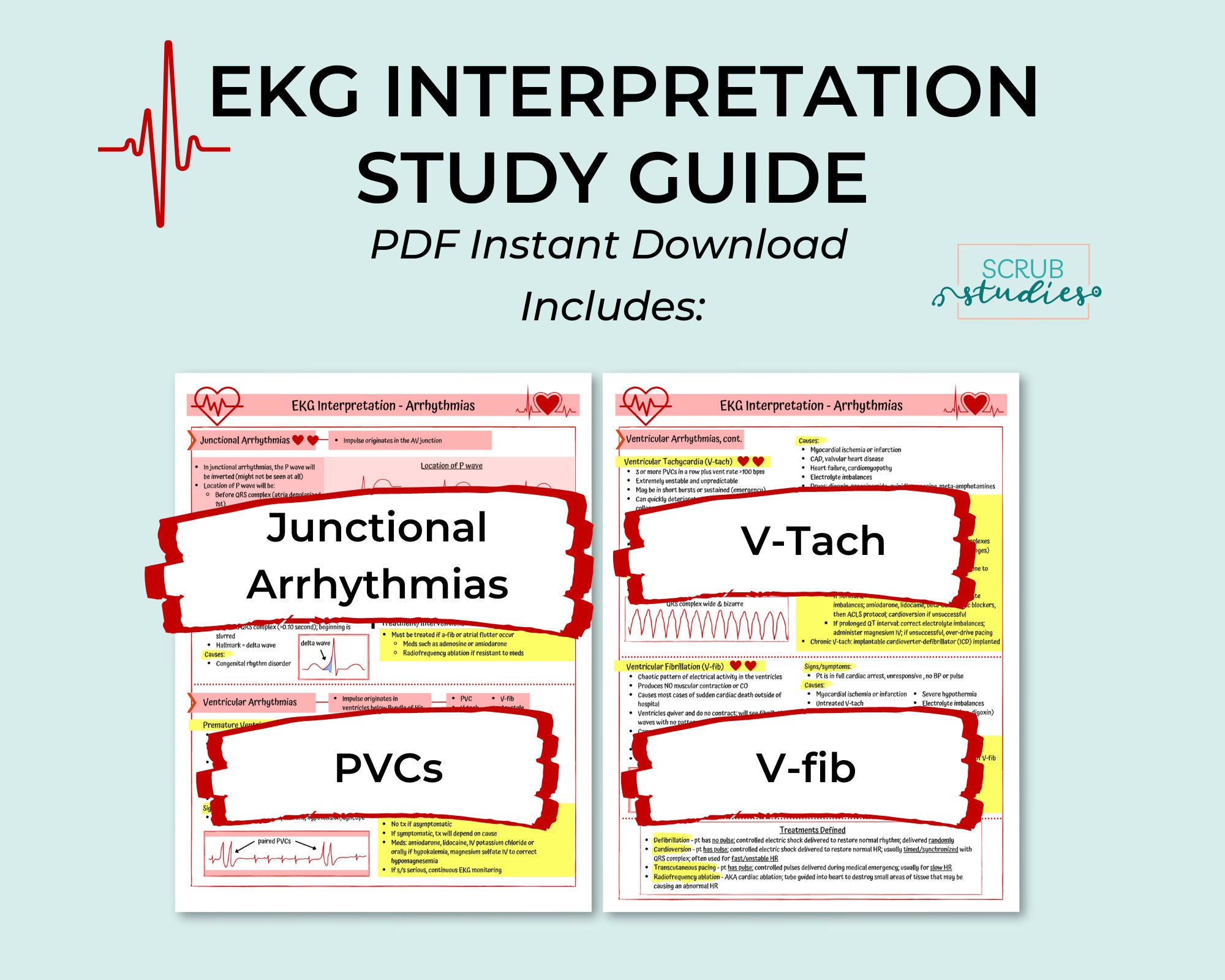 EKG Interpretation Study Guide | EKG Arrhythmias | ECG | Nursing ...