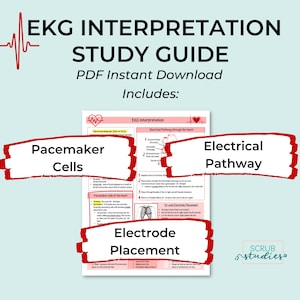 EKG Interpretation Study Guide | EKG Arrhythmias | ECG | Nursing ...