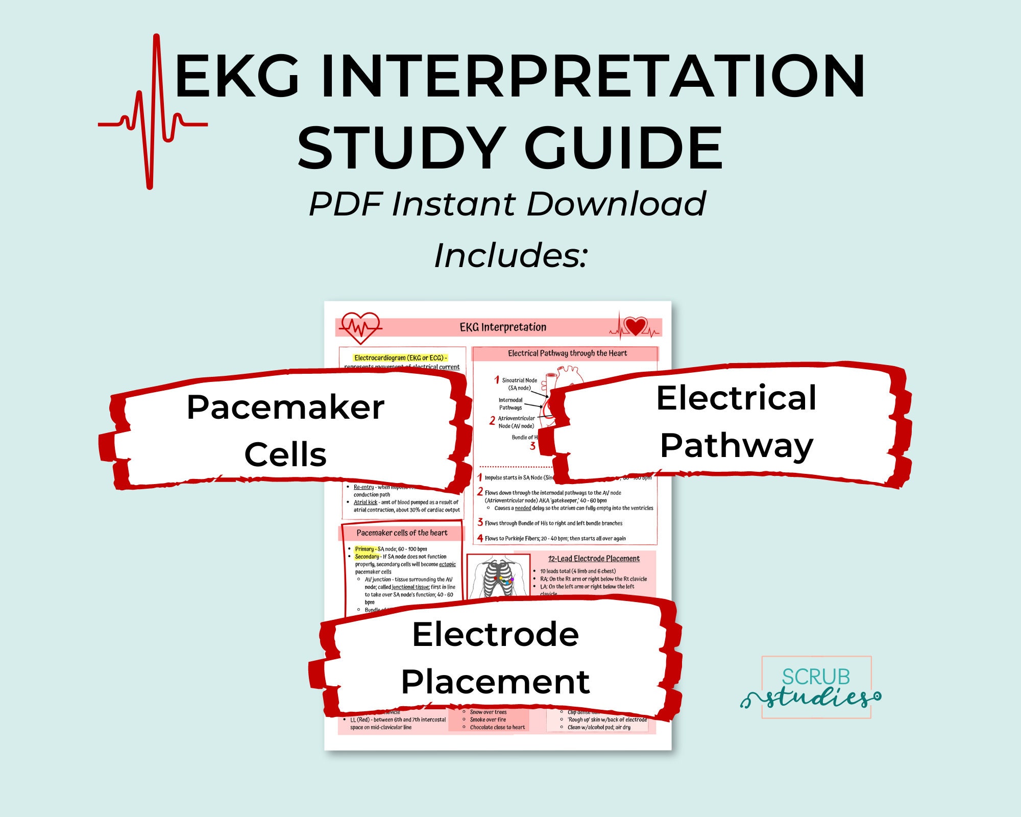 EKG Interpretation Study Guide | EKG Arrhythmias | ECG | Nursing ...