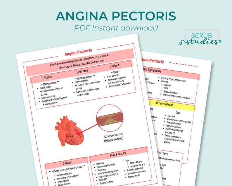 Cardiac Bundle Study Guide Nursing Study Guide Heart - Etsy