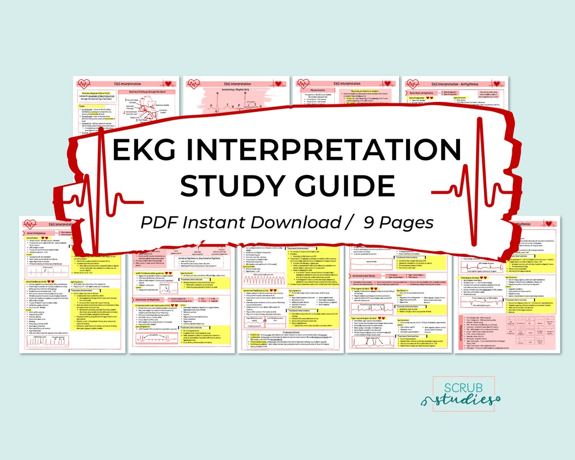EKG Interpretation Study Guide | EKG Arrhythmias | ECG | Nursing ...