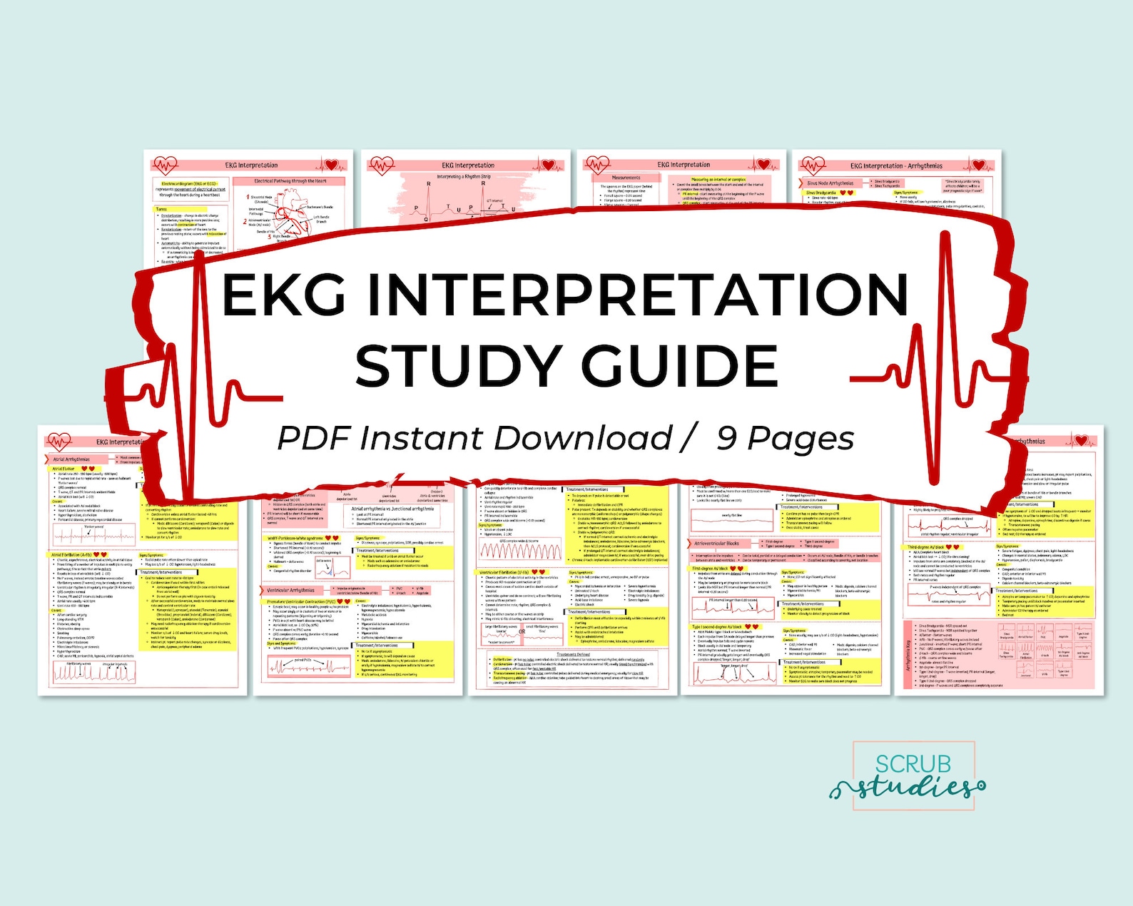 EKG Interpretation Study Guide | EKG Arrhythmias | ECG | Nursing ...