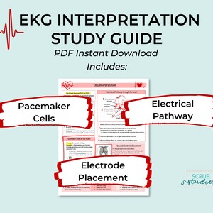 EKG Interpretation Study Guide EKG Arrhythmias ECG - Etsy