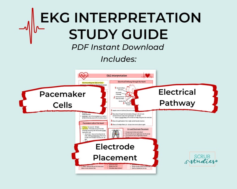 EKG Interpretation Study Guide EKG Arrhythmias ECG - Etsy