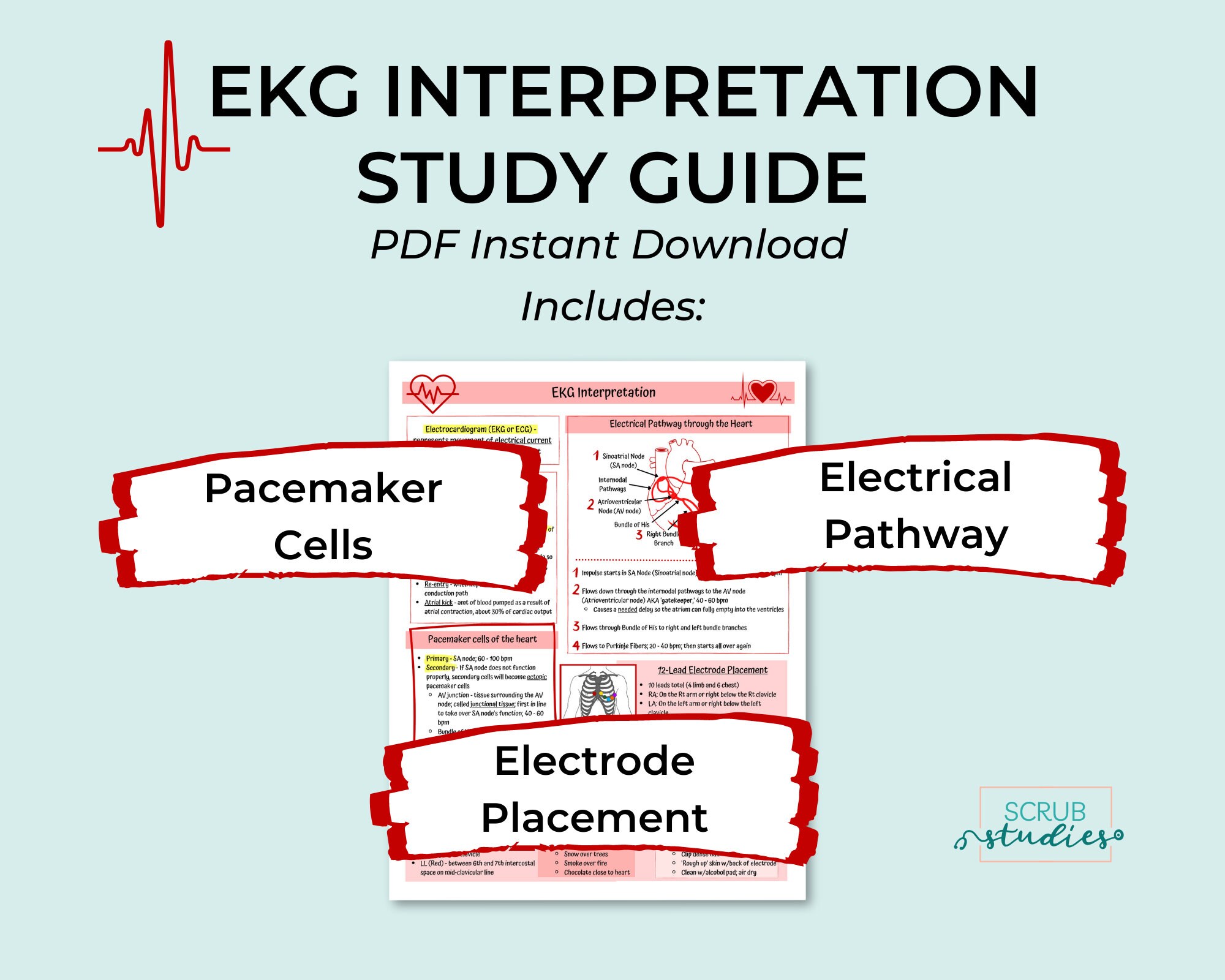EKG Interpretation Study Guide EKG Arrhythmias ECG - Etsy
