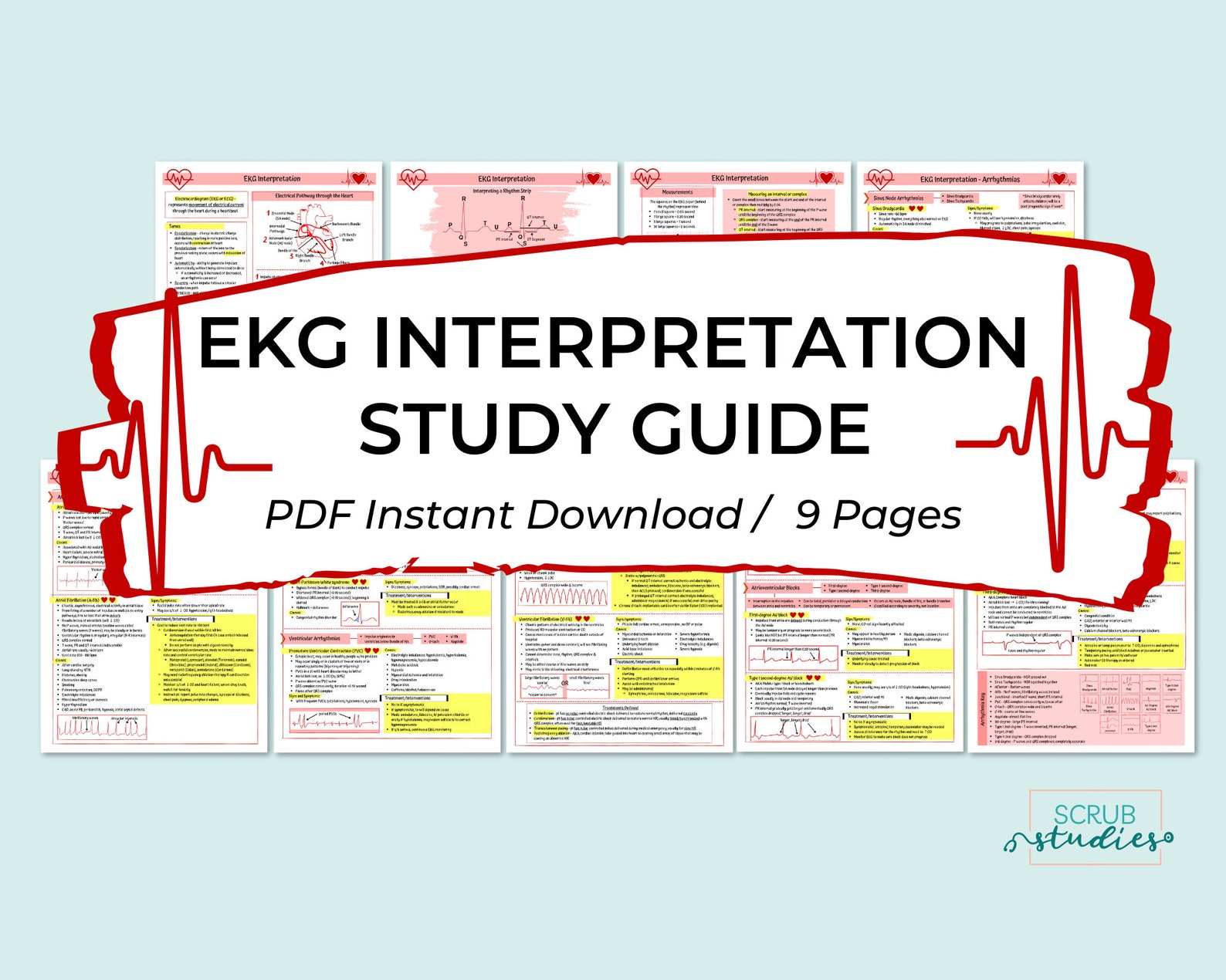EKG Interpretation Study Guide EKG Arrhythmias ECG - Etsy