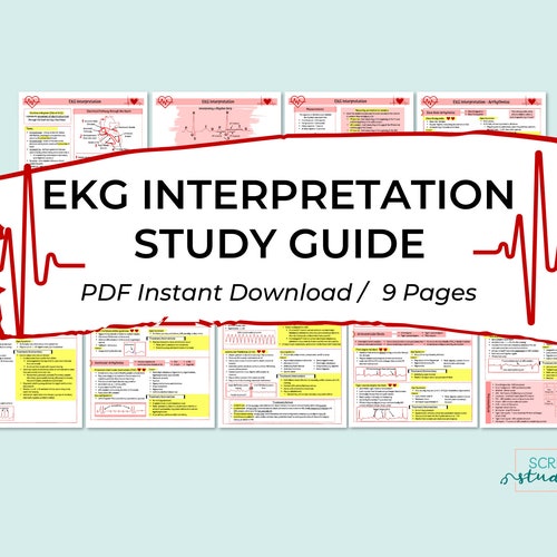 EKG Interpretation Study Guide EKG Arrhythmias ECG - Etsy
