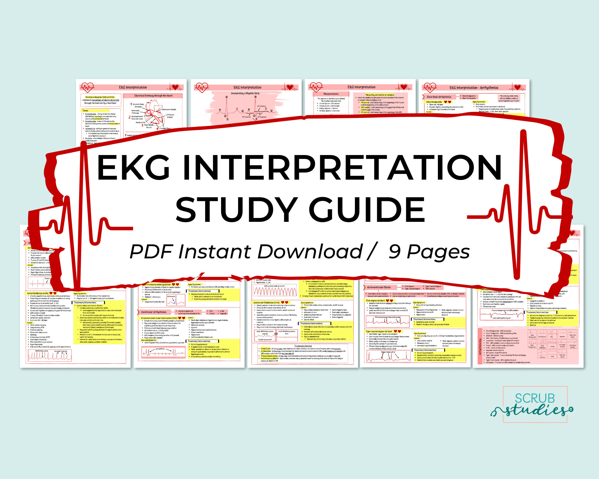 EKG Interpretation Study Guide EKG Arrhythmias ECG - Etsy