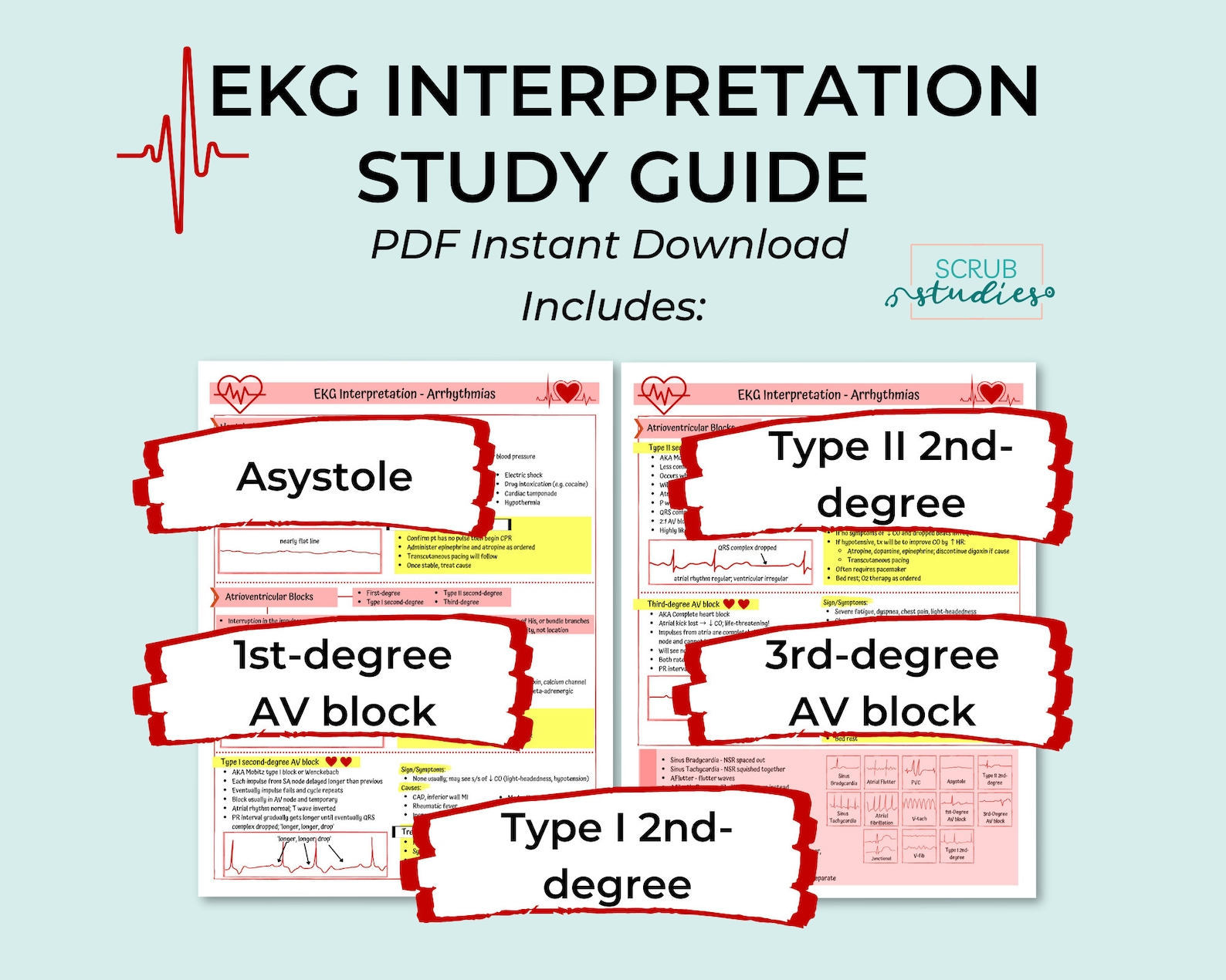 EKG Interpretation Study Guide | EKG Arrhythmias | ECG | Nursing ...