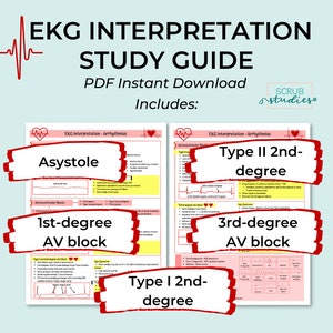 EKG Interpretation Study Guide | EKG Arrhythmias | ECG | Nursing ...