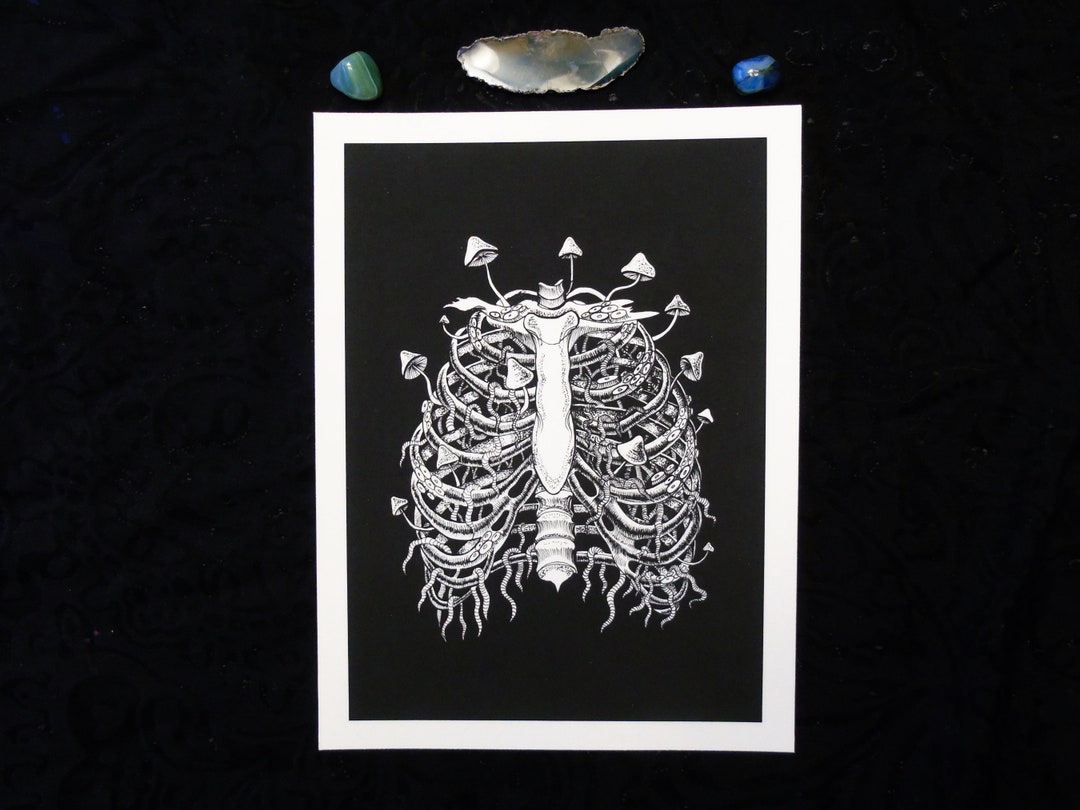 Festering II | Rotting Ribcage and Mushrooms Giclée Print - Etsy
