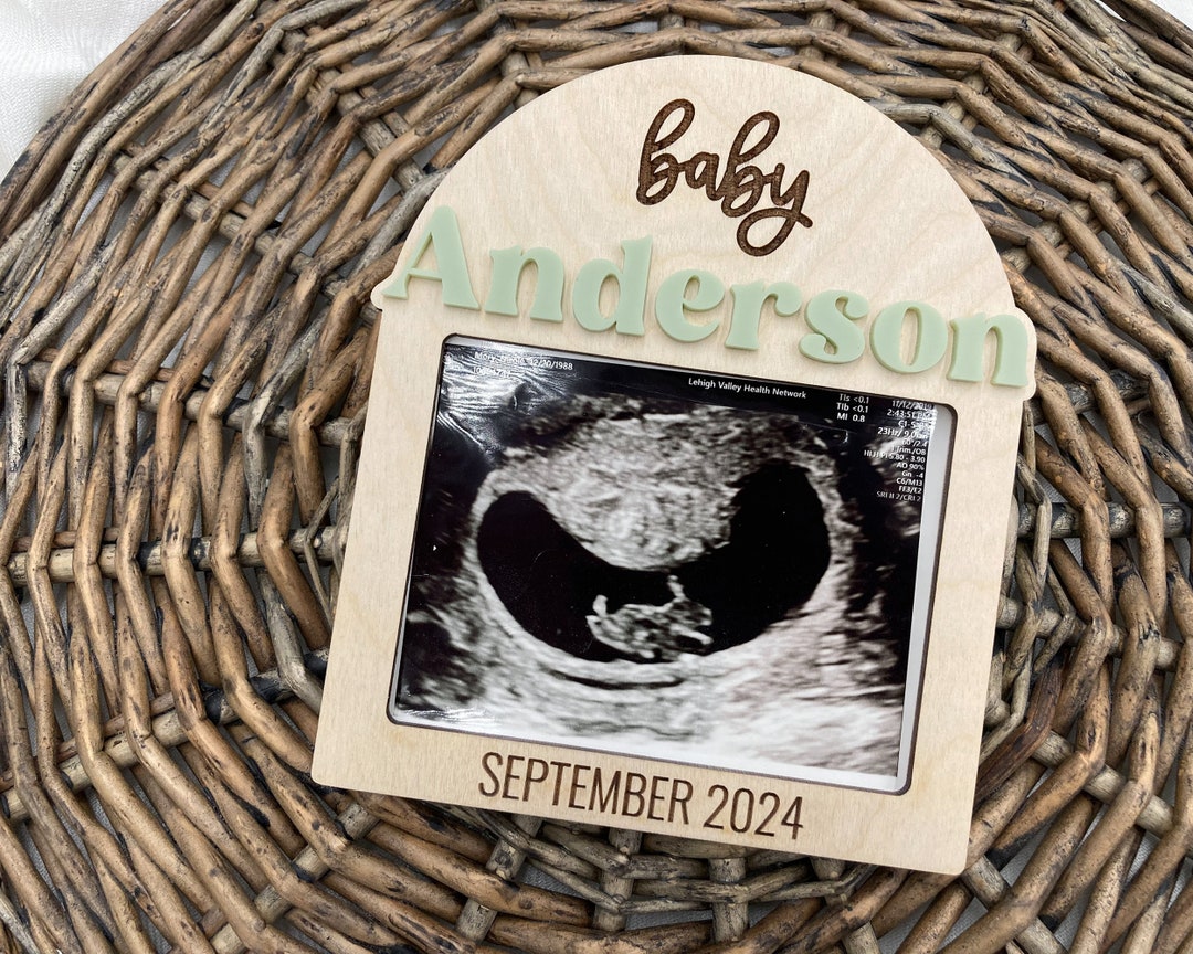 Personalized Magnetic Ultrasound Picture Frame Birth Announcement Sign ...