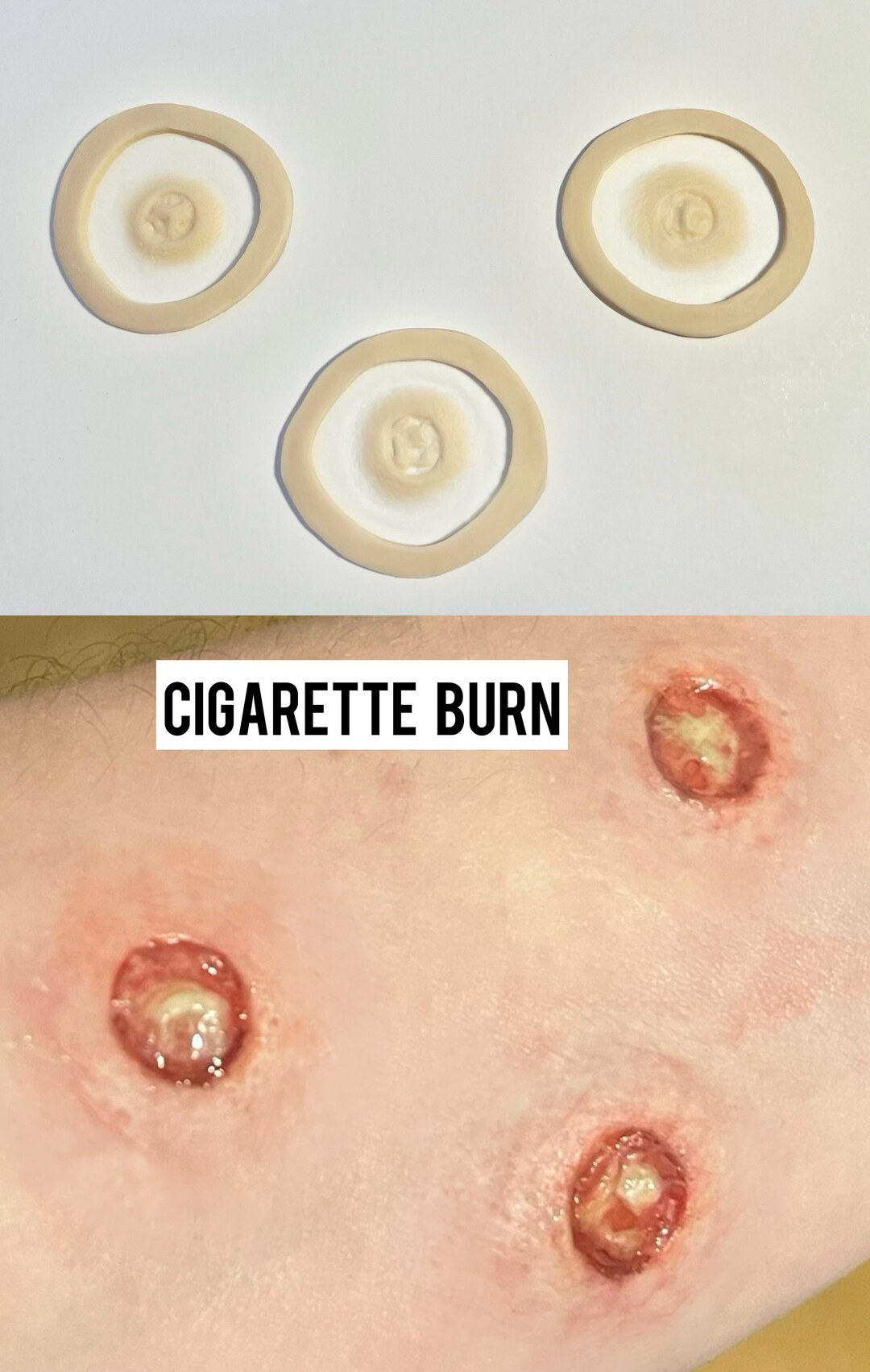 Burn Skin Silicone Prosthetic - Injury Makeup Wound Blister Casualty ...