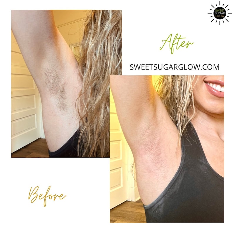 8 Oz Pot of Gold Sugar Paste for All Natural Hair Removal, Sugar Wax ...