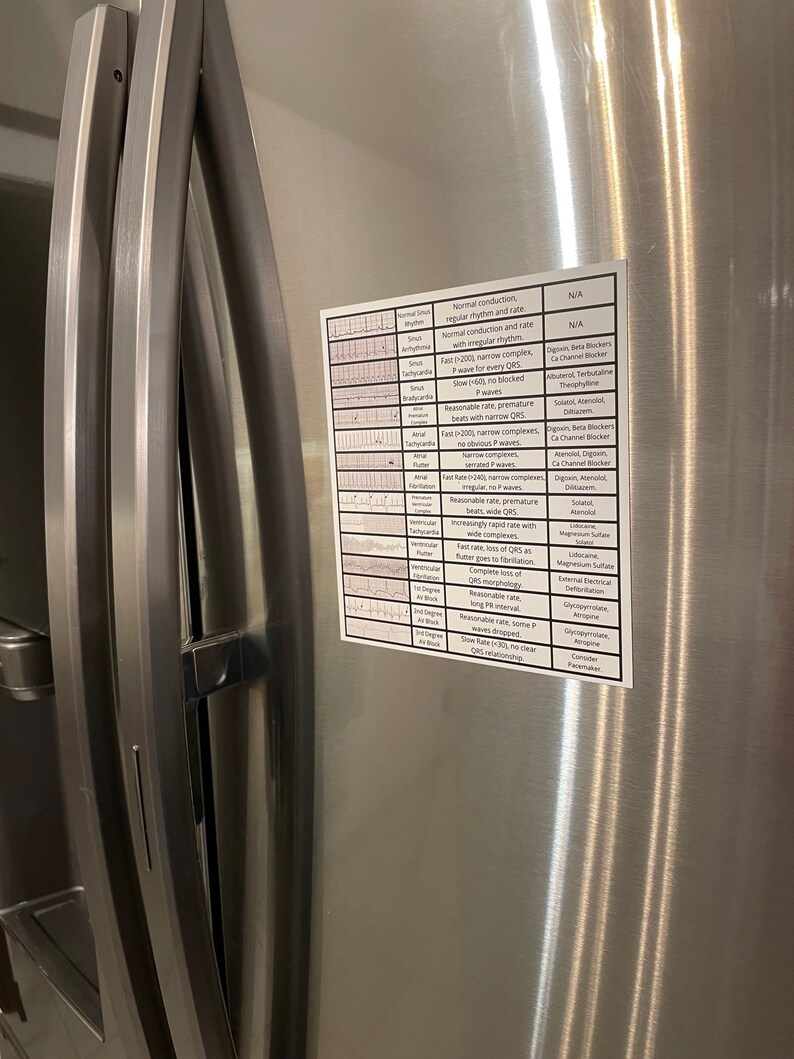 Veterinary ECG Tracings Chart Magnetveterinary Cardiology - Etsy