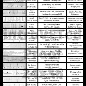 Veterinary ECG Chart Digital Download,veterinary Cardiac Chart ...