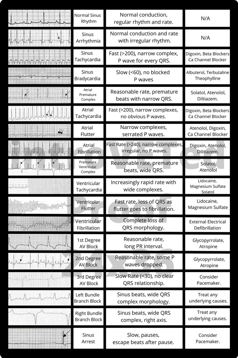 Veterinary ECG Chart Digital Downloadveterinary Cardiac Chart - Etsy