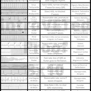 Veterinary ECG Chart Digital Download,veterinary Cardiac Chart ...