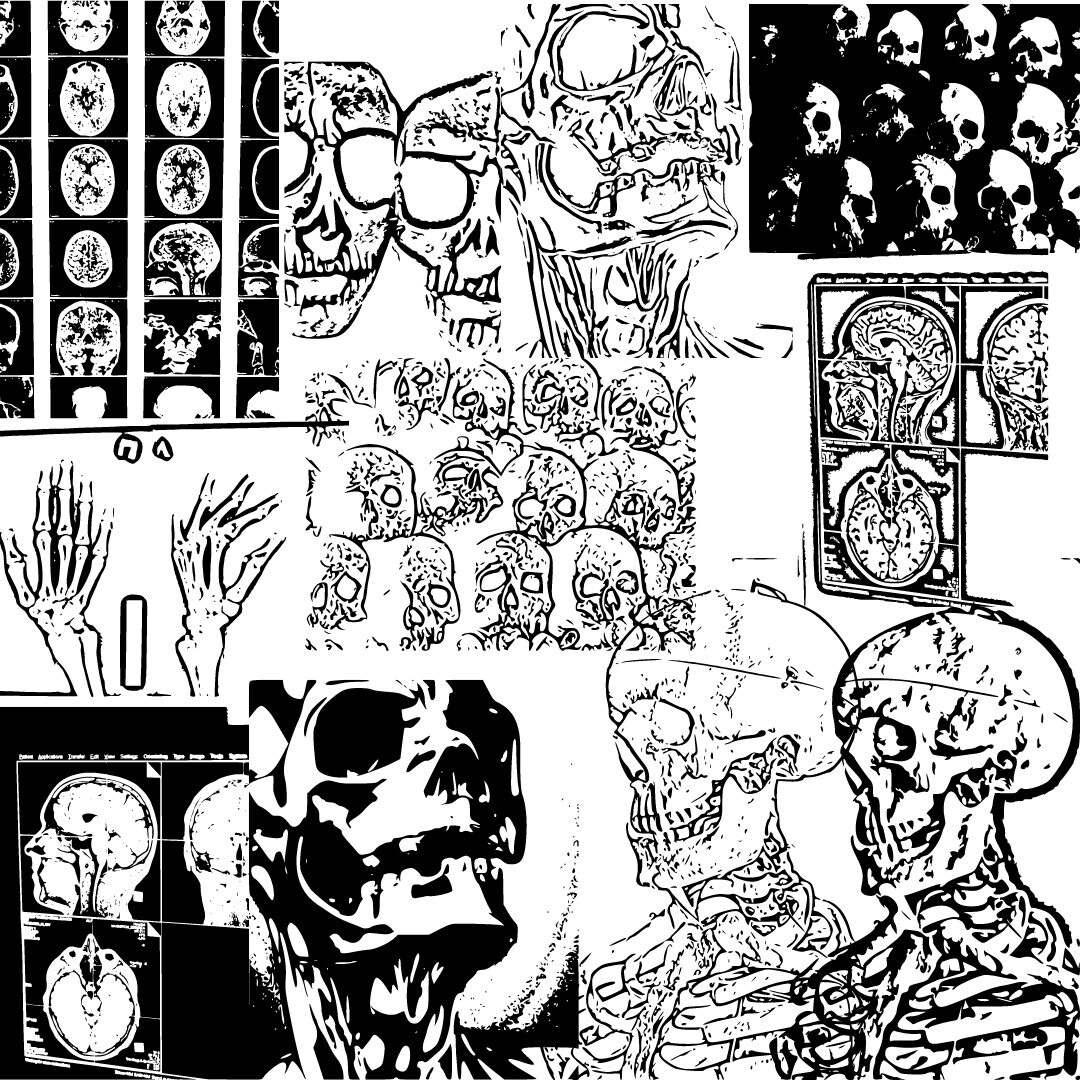 Skulls Skeleton Brain Scans SVG Pack Hand X-ray Designs Illustration ...