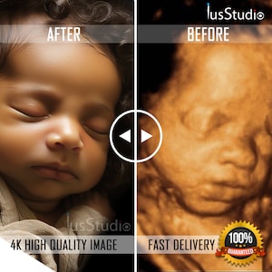 3D/4D Ultrasound Baby Scan to Real Image - New Mom Gift - Etsy